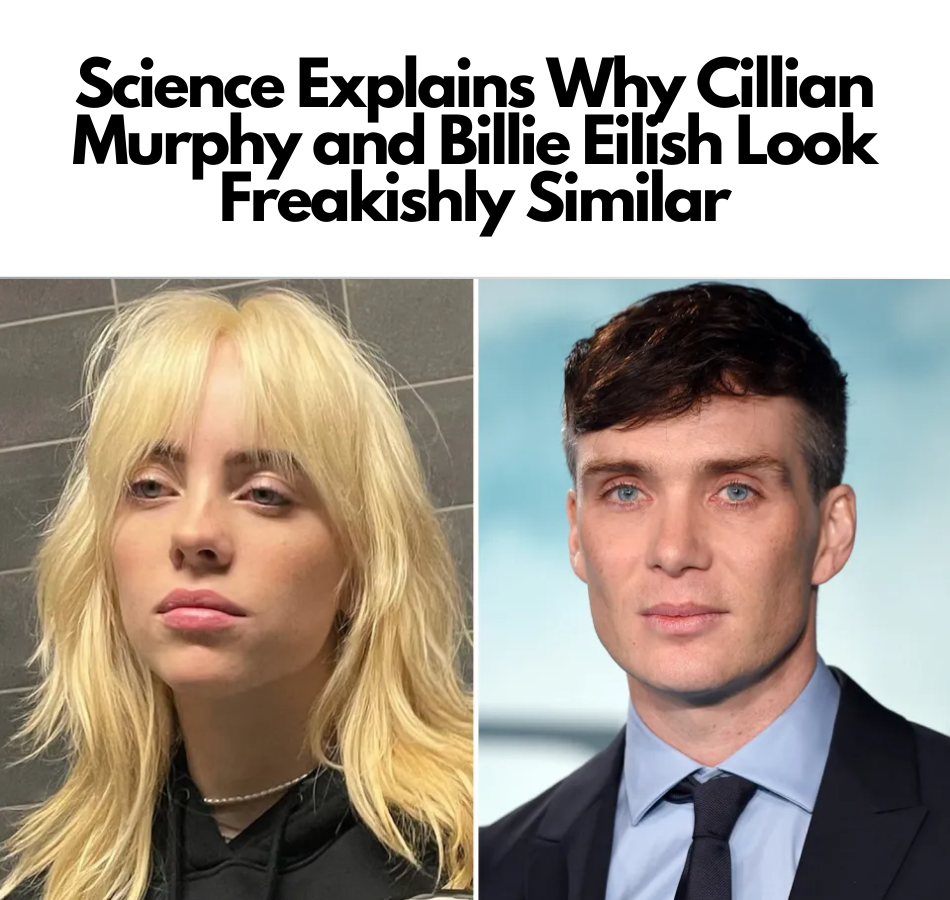 Science Explains Why Cillian Murphy and Billie Eilish Look Freakishly ...